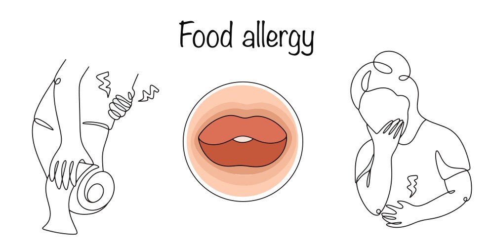 Food Allergy Symbols Vector Images (over 13,000)