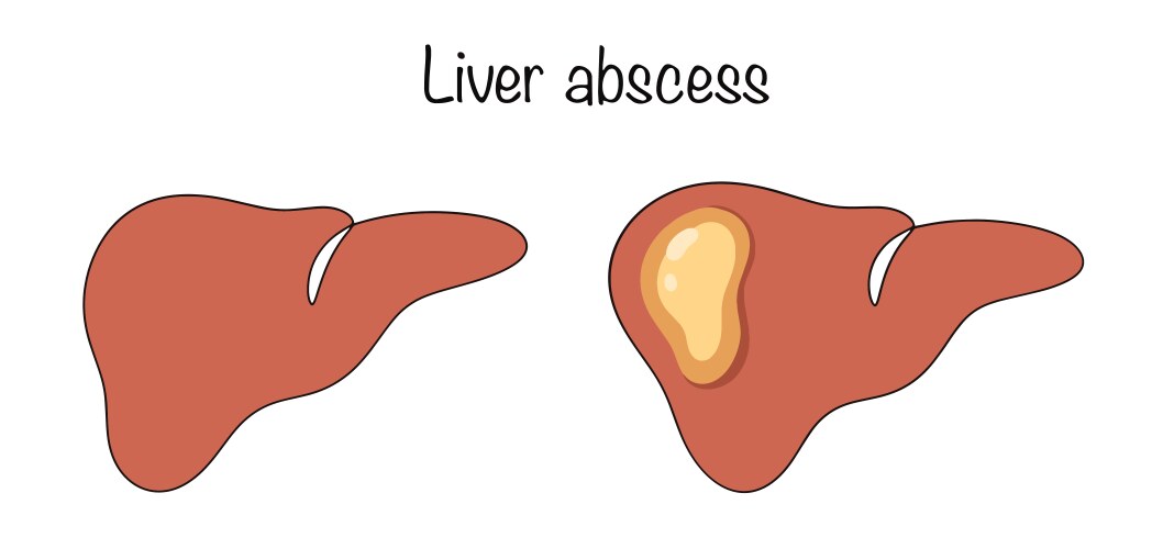 Liver Vector Images (over 24,000)
