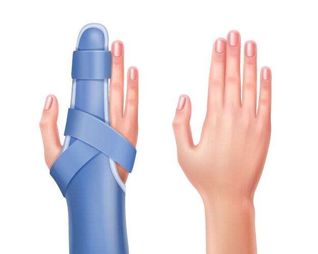 Hand Injury Vector Images (over 16,000)