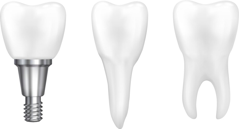 Tooth anatomy Royalty Free Vector Image - VectorStock