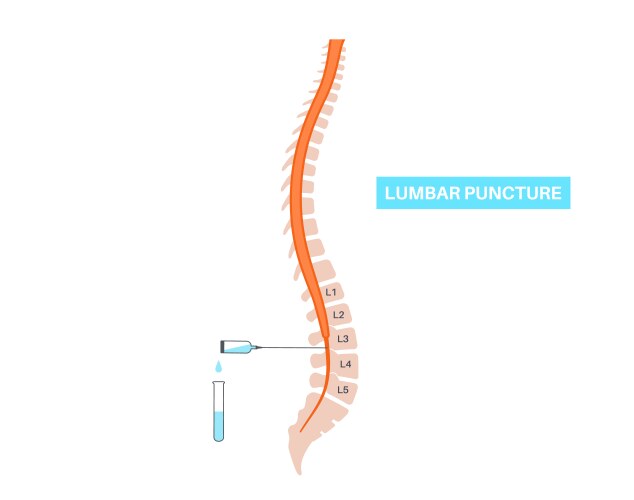 Spinal Tap Vector Images (26)