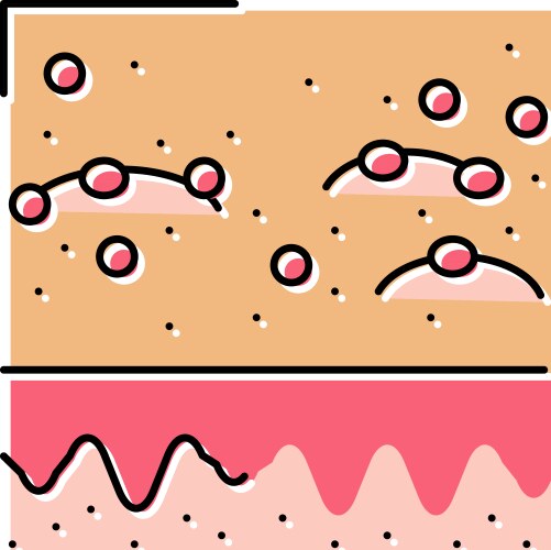 Red Rash Vector Images (over 2,800)