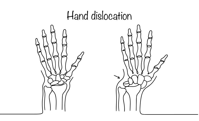 Hand Accident Vector Images (over 17,000)