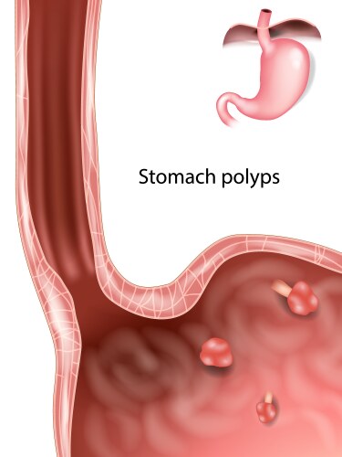 Esophagus Vector Images (over 2,900)