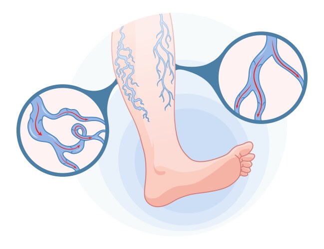 Normal skin without varicose veins healthy Vector Image