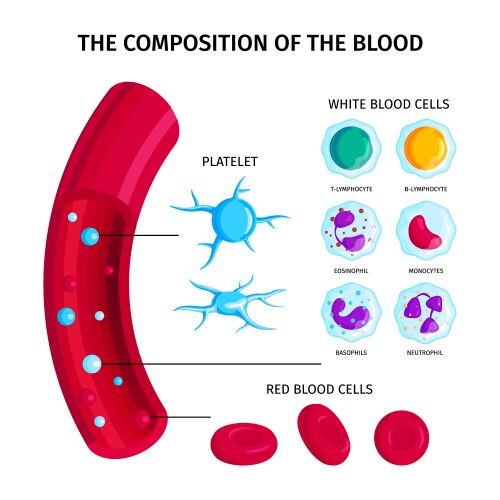 Hemophilia infographics poster Royalty Free Vector Image