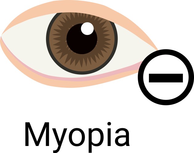 Optical human eye defects myopia and hyperopia Vector Image