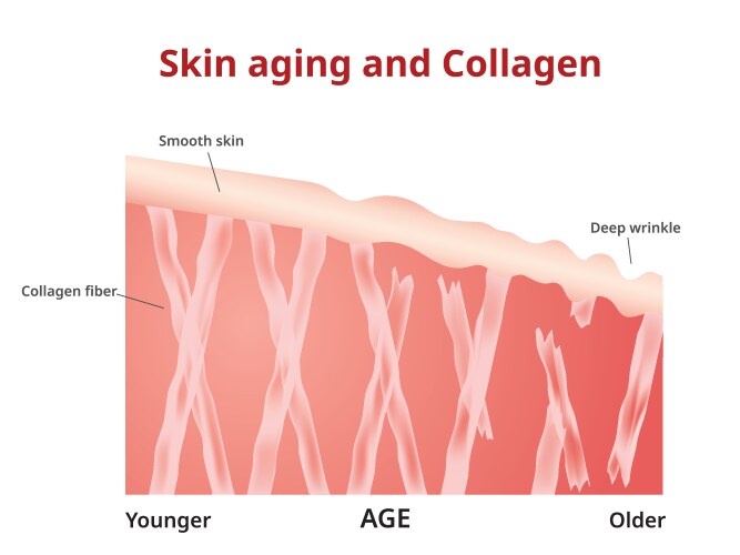 Skin Aging: Collagen Decline Diagram – Royalty-Free Vector | VectorStock