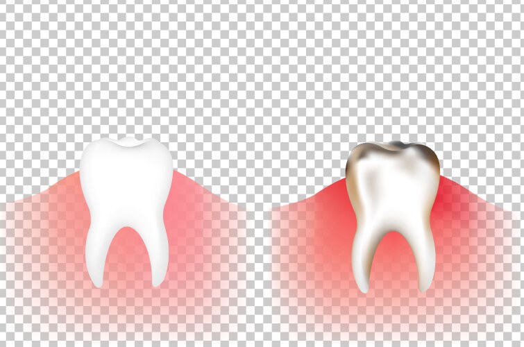 Zub Royalty Free Vector Image - VectorStock