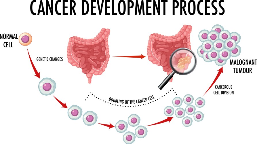 Diagram showing cancer development process Vector Image