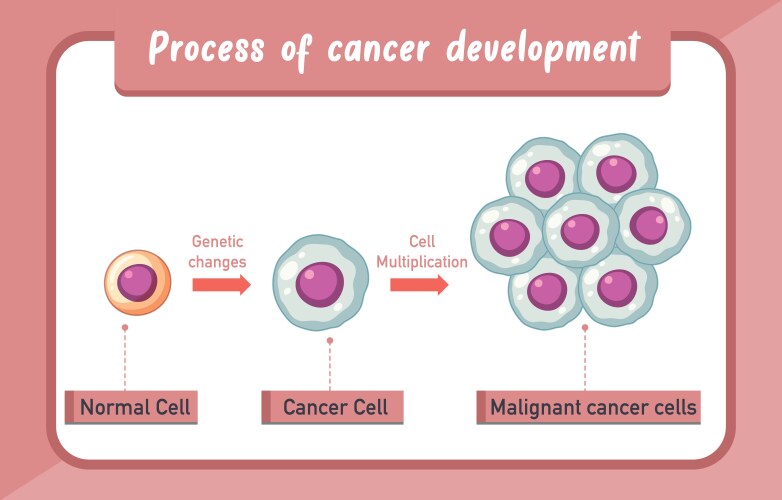 Cancer development process infographic Royalty Free Vector