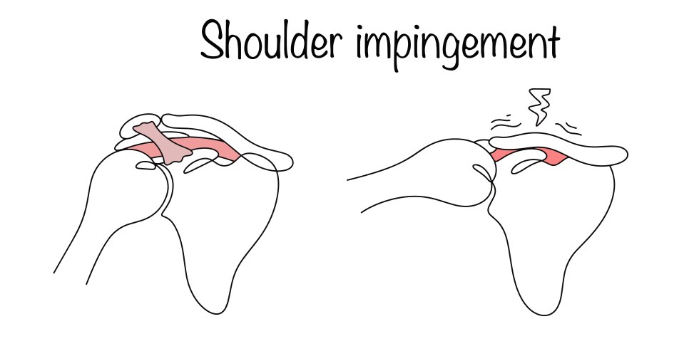 Shoulder Roll Exercise Vector Images (7)