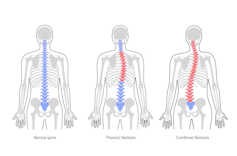 Skeleton Diagram Vector Images (over 1,600)