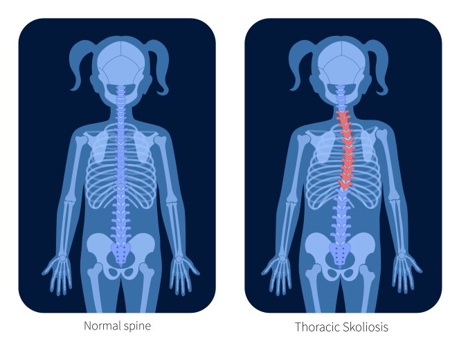 Spine x ray Royalty Free Vector Image - VectorStock