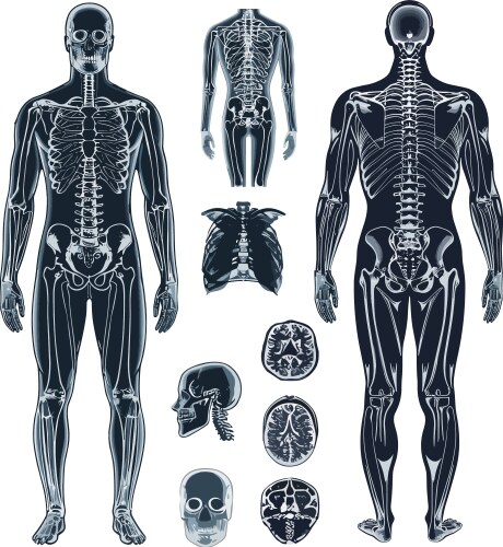 X-Ray Vector Images (over 21,000)