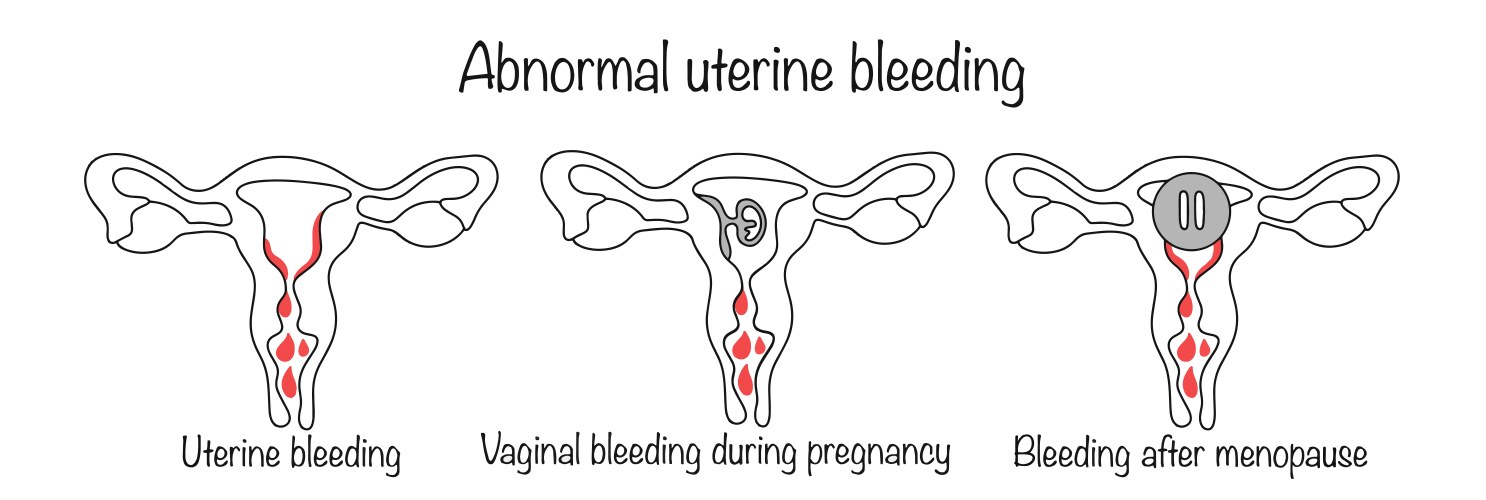 Uterine Vector Images (over 2,000)