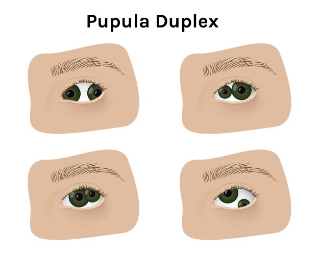 Realistic human eyes with polycoria Royalty Free Vector