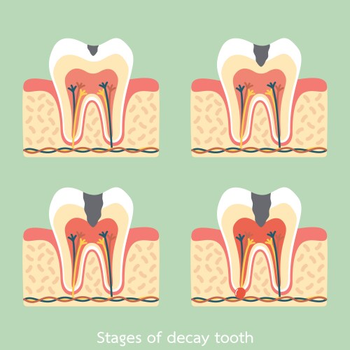 Tooth anatomy chart orthodontist human teeth loss Vector Image