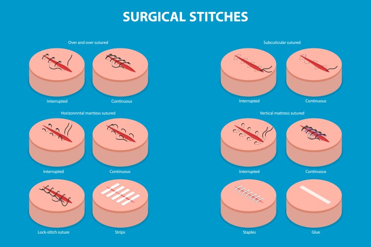 Surgery Medical Stitches Vector Images (over 480)