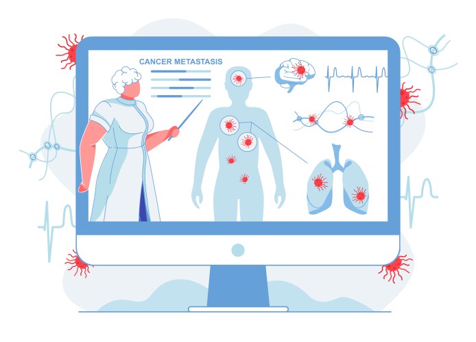 Lung Cancer Cartoon Vector Images (over 1,500)