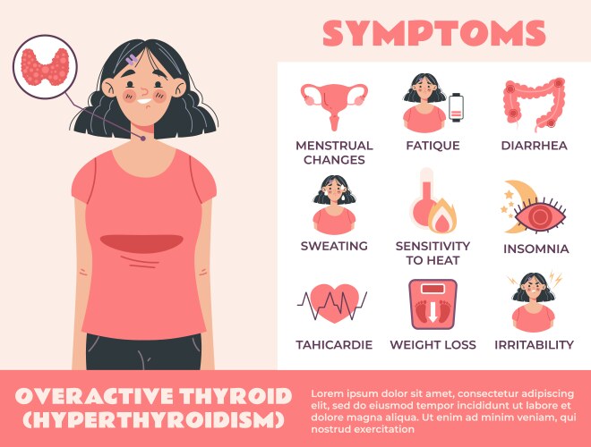 Hyperthyroidism symptoms Royalty Free Vector Image