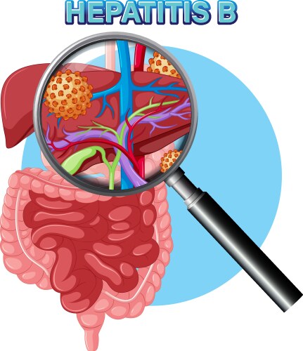 Informative poster of common symptoms hepatitis b Vector Image