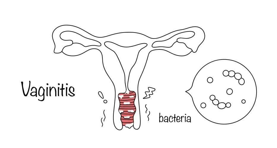 Vaginal Pain Vector Images (over 280)