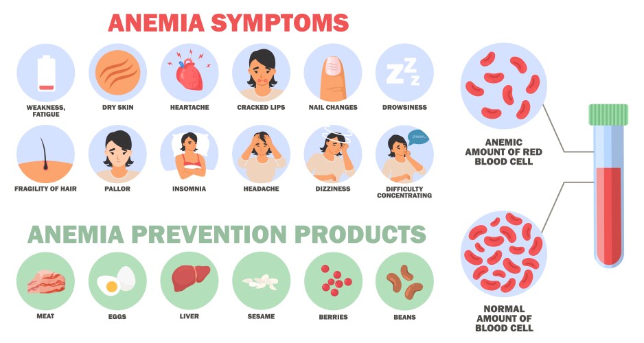 Anemia symptoms hematology icons anaemia disease Vector Image