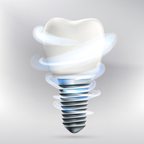 Dental Implant Vector Images (over 19,000)