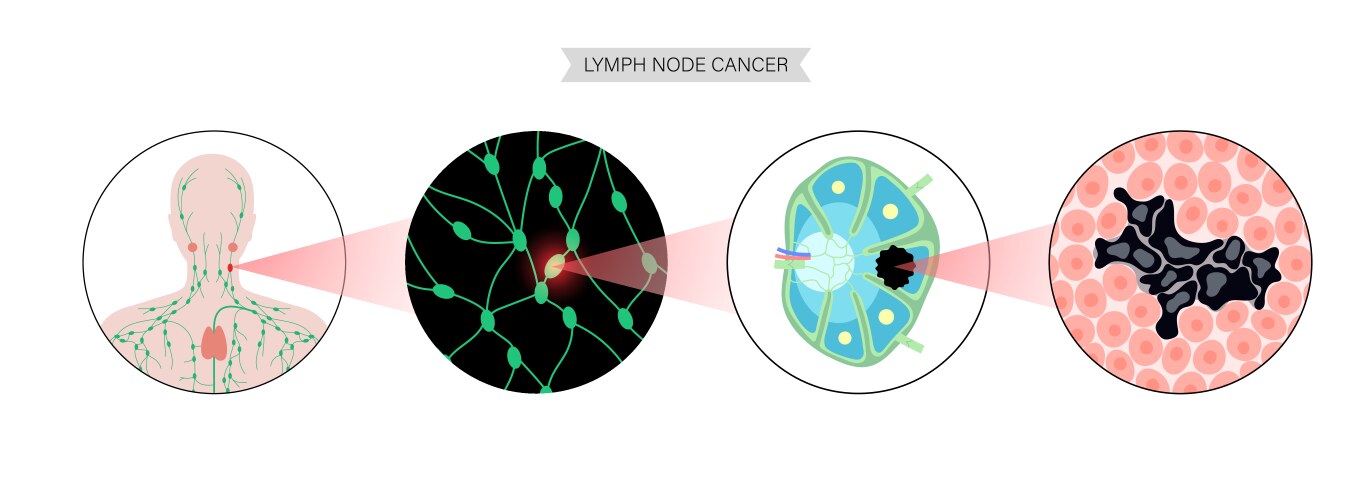 Cancer Vector Images (over 110,000)