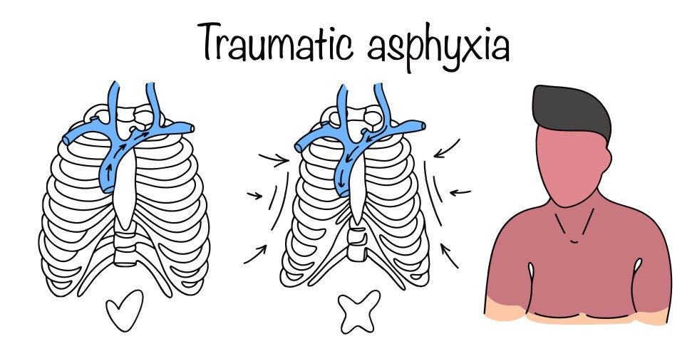 Ambulance Drawing Vector Images (over 3,500)