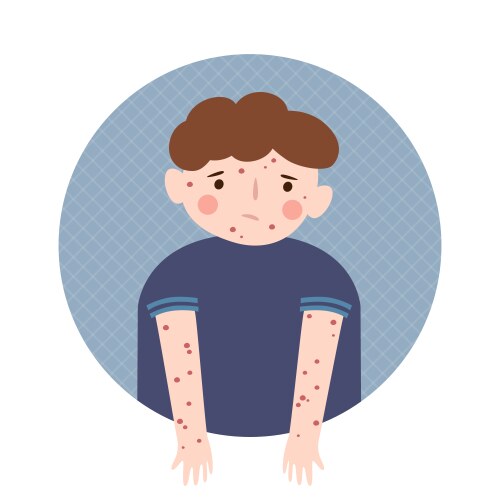 Chickenpox Vector Images (over 660)