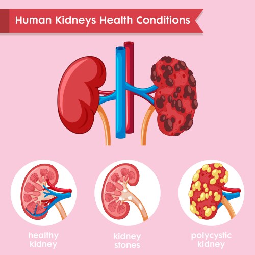 Cartoons Kidney Vector Images (over 4,100)