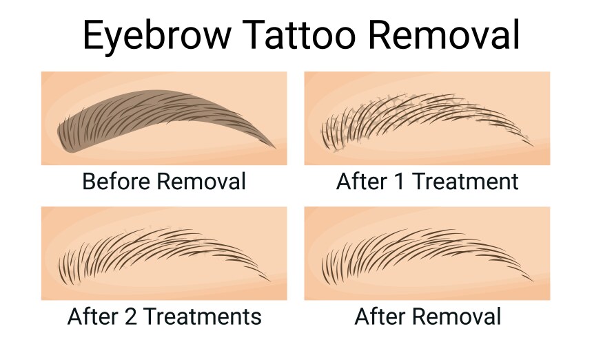 Eyebrow Coloring Transformation Before And After Vector Image