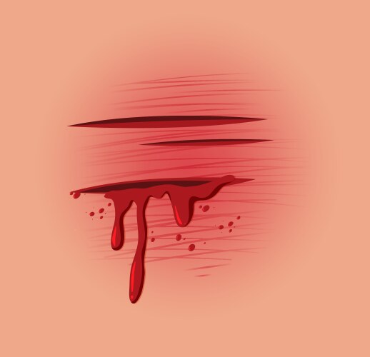 Cleaning Wound Vector Images (over 710)