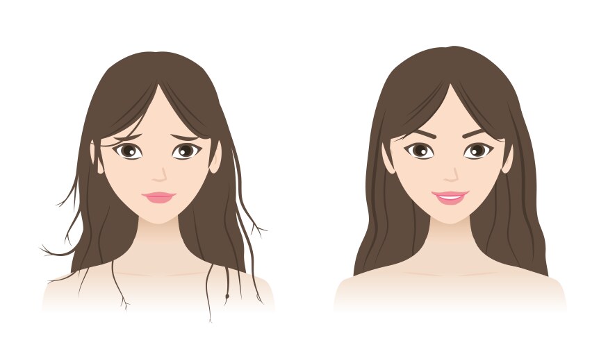 Types of split ends hair with scalp layer Vector Image