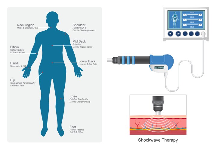 Shock Vector Images (over 85,000)