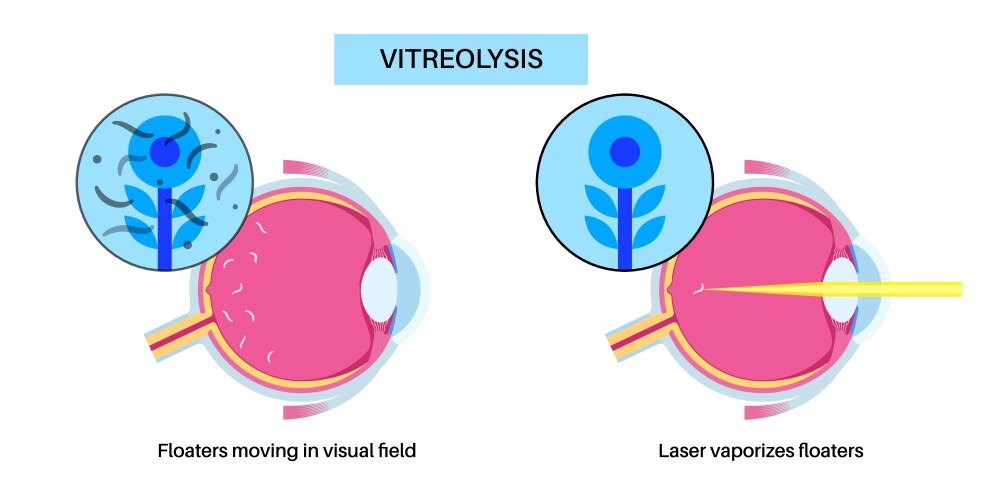 Laser Vector Images (over 130,000)