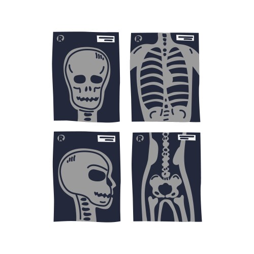 Radiology Skull Vector Images (over 300)