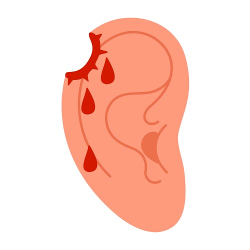 Bullet Wound Vector Images (over 170)