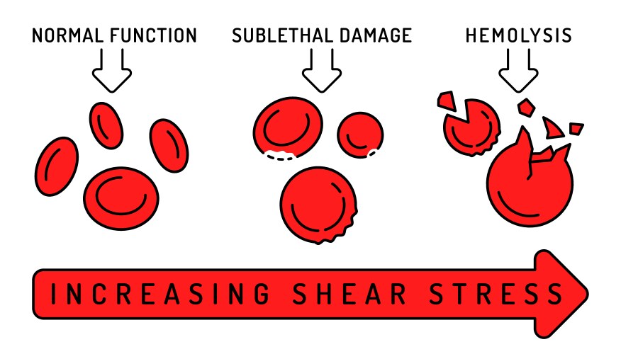 Hemolytic anemia infographic Royalty Free Vector Image