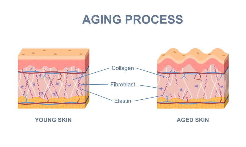Aging process face skin structure changes cross Vector Image