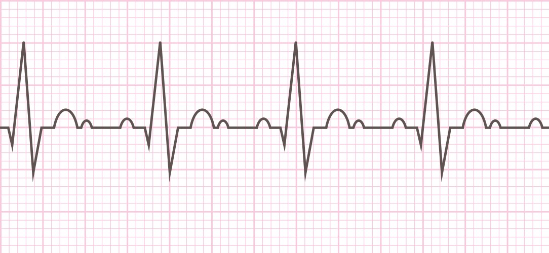 Heart cardiogram charts set healthy Royalty Free Vector