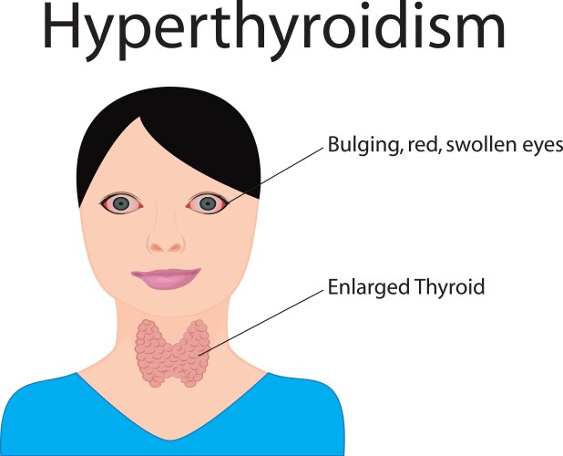 Thyroid human internal organ of endocrine system Vector Image