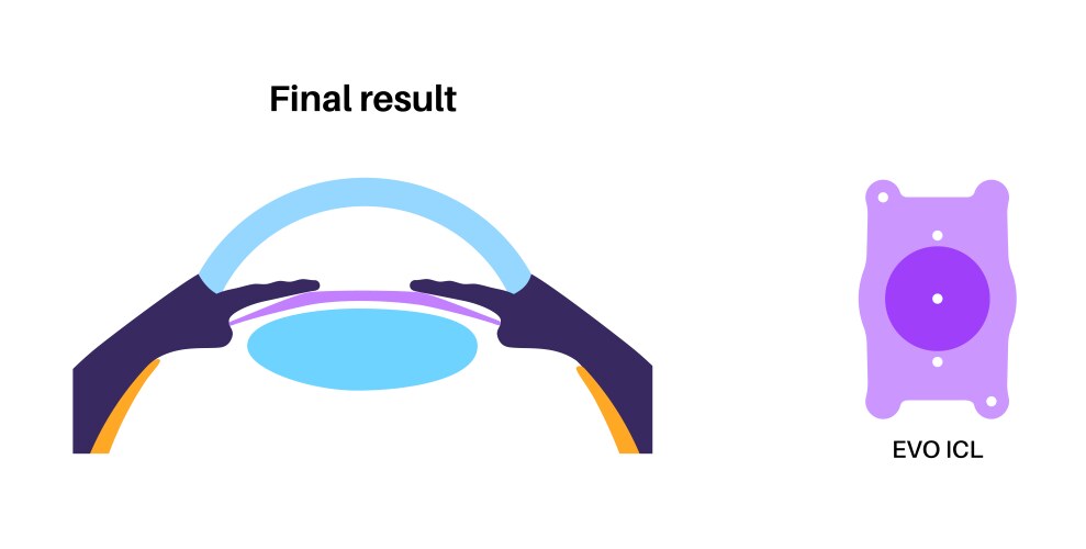 Evo icl poster Royalty Free Vector Image - VectorStock