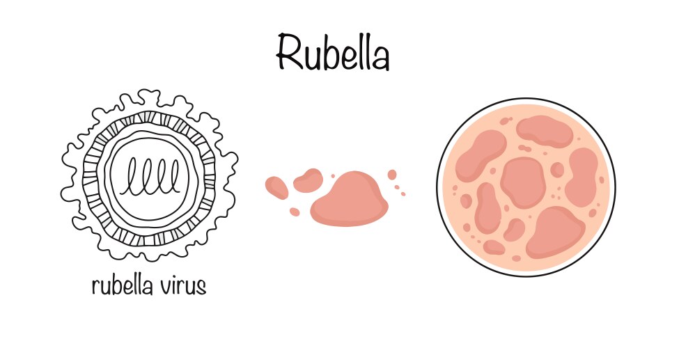 Heat rash Royalty Free Vector Image - VectorStock