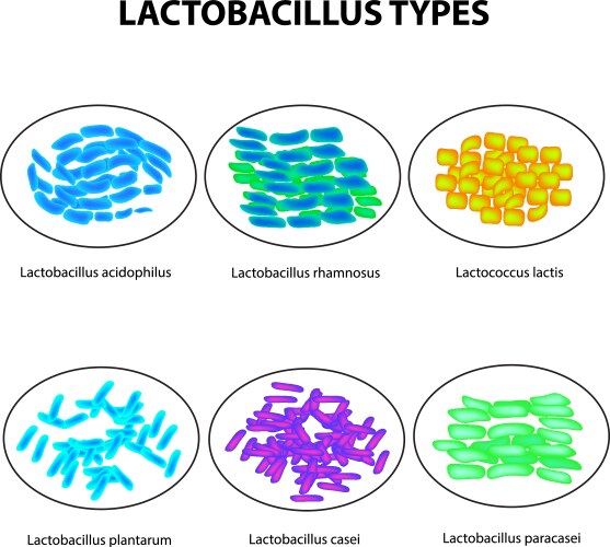 Classification of probiotics infographics Vector Image