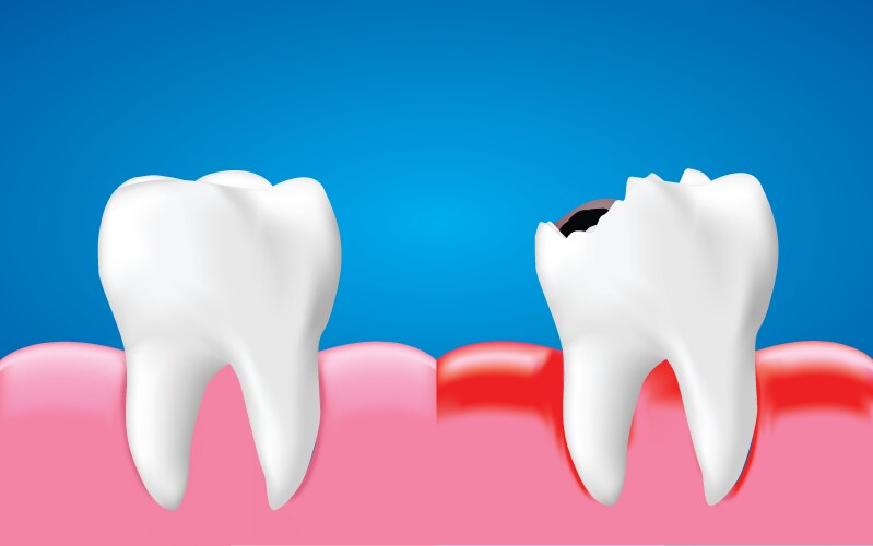 Tooth Vector Images (over 150,000)