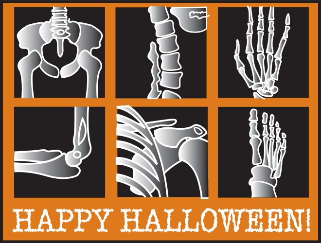 Different x-rays shot human body part set Vector Image