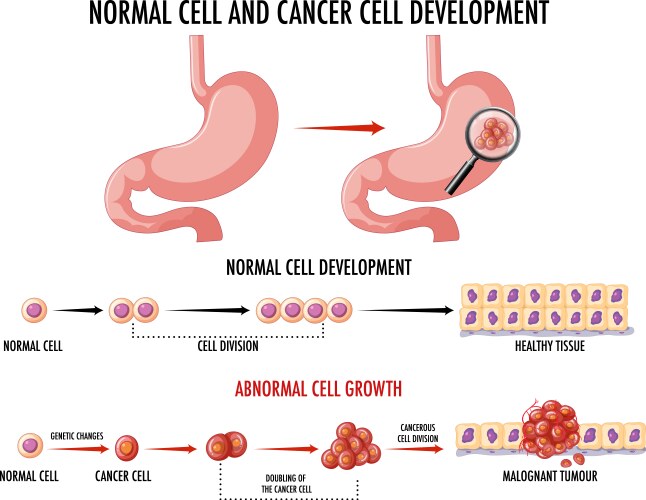 Diagram showing cancer development process Vector Image
